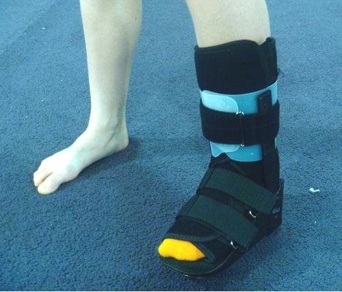 gymnast foot cast – Gymnastics Coaching.com