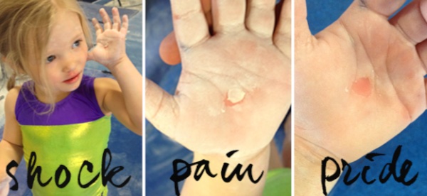on hand rips – Gymnastics Coaching.com